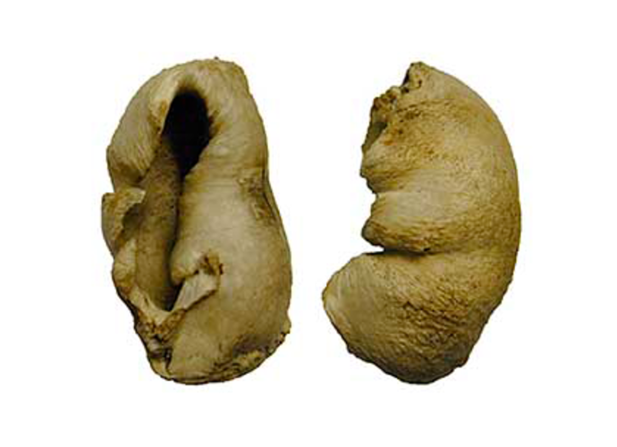 Blue whale | The Learning Zone